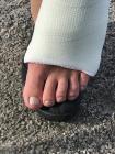 Links to other Cast and Brace sites @ Cast Central